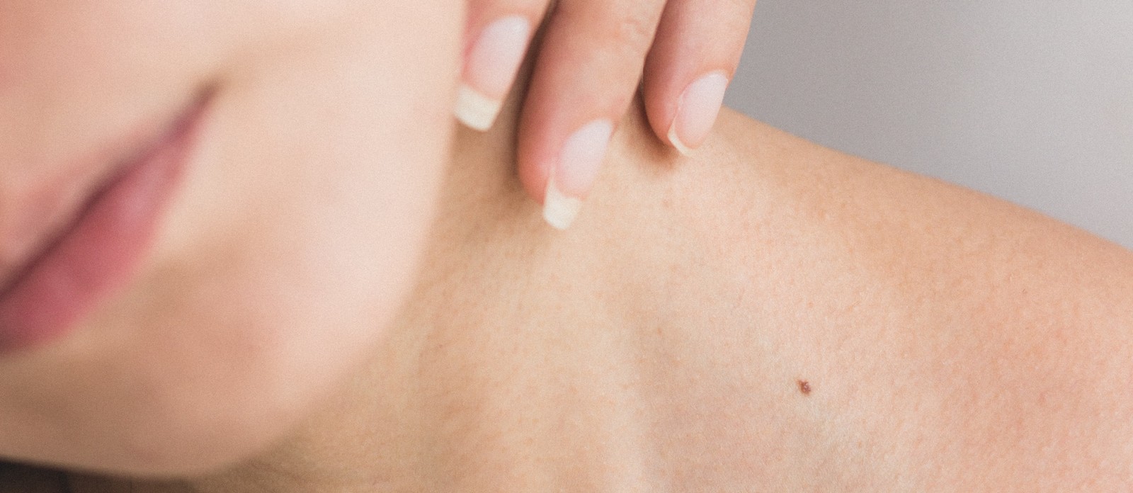 What is the most obvious sign that someone has prickly heat?